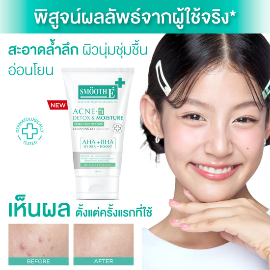 Smooth E Acne-5 Detox & Moisture Extra Sensitive Cleansing Gel
