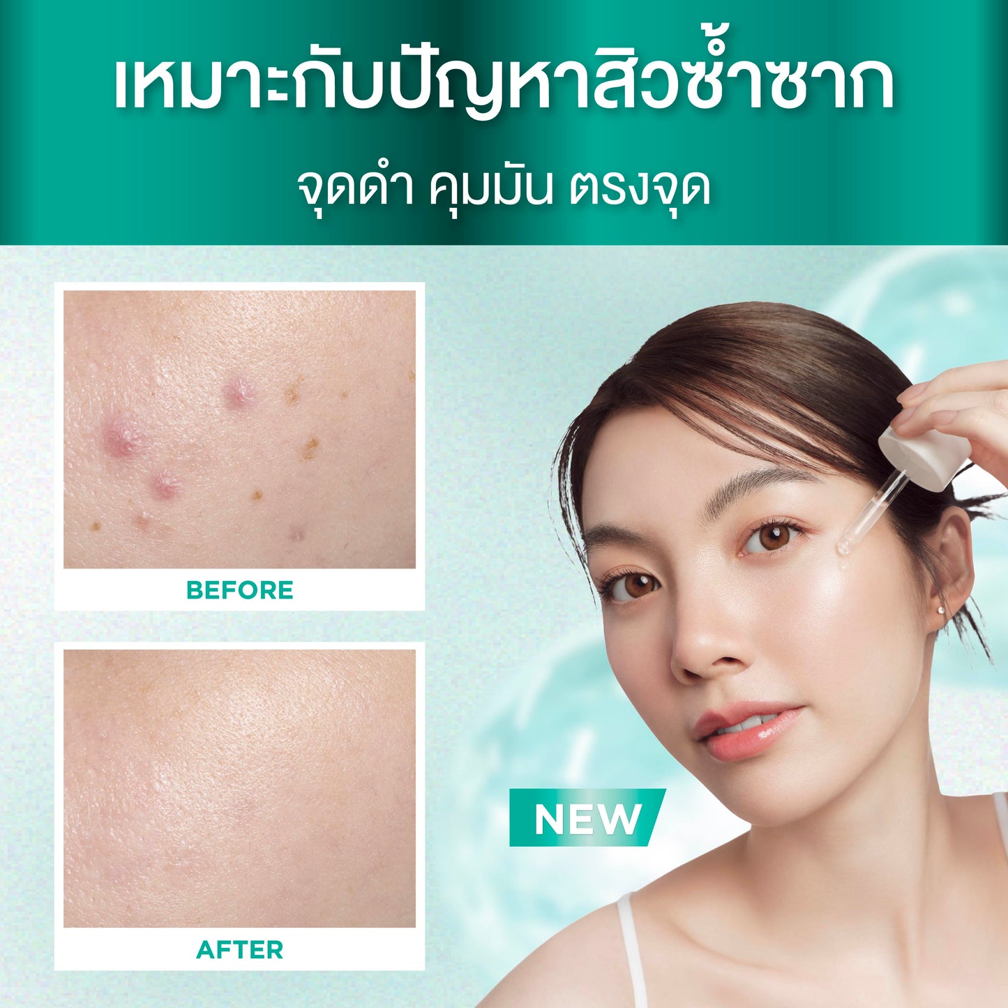 SME PHA-AHA ACNE SPOT AND PORE SMOOTH 30 G.